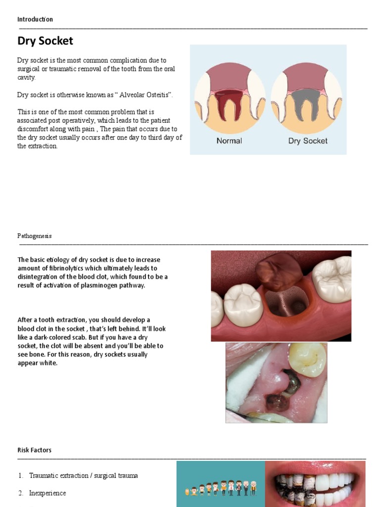 Dry Socket Presentation | PDF | Clinical Medicine | Medical Specialties