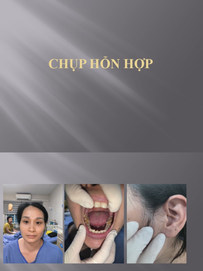 CH P H N H P Gưi SV | PDF
