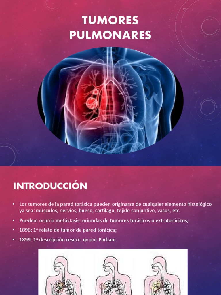 Tumores de Torax | PDF | Cáncer | Sarcoma