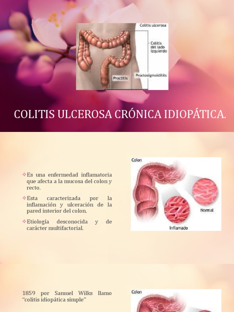 Colitis Ulcerosa: Síntomas y Tratamiento | PDF | Inmunología ...
