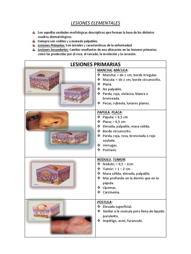 Lesiones Cutáneas: Primarias y Secundarias | PDF | Piel ...