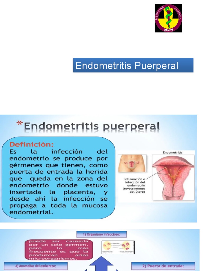 Tratamiento de Endometritis Puerperal | PDF