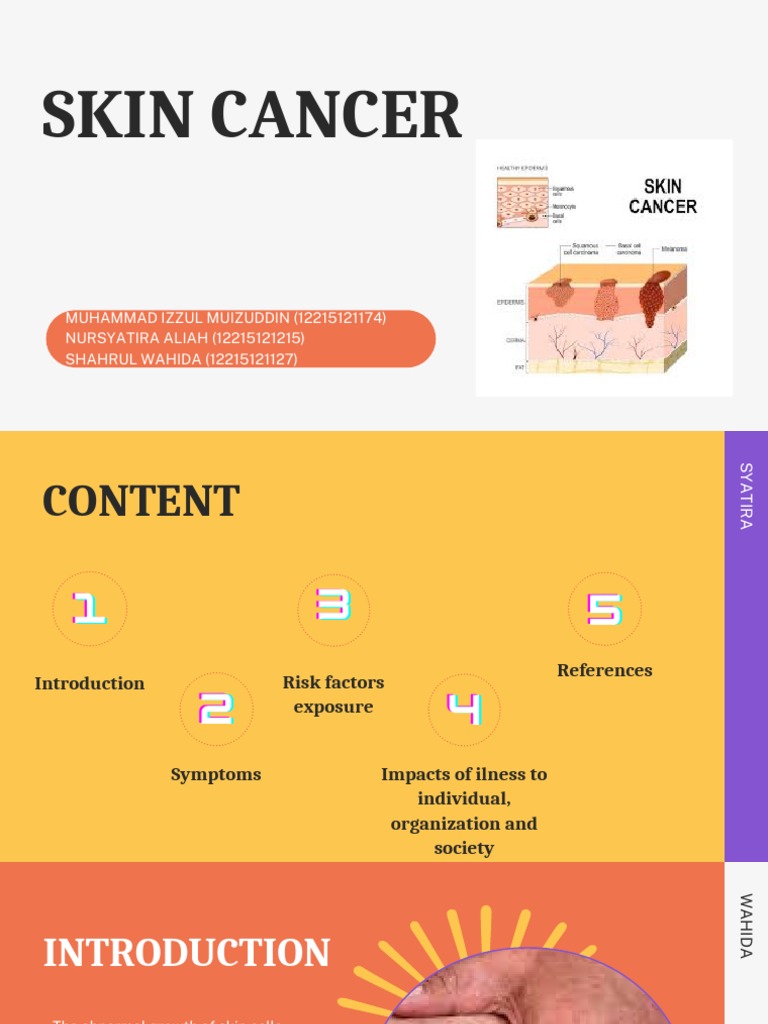 Skin Cancer | PDF | Skin Cancer | Cancer