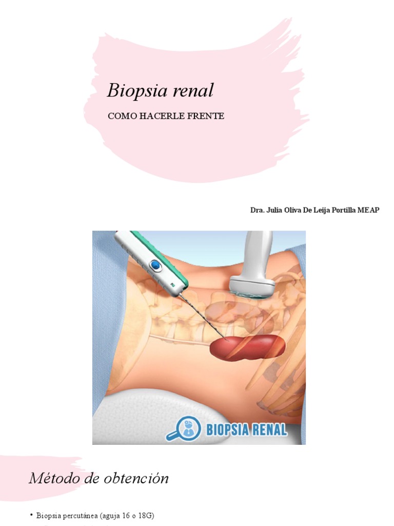 Copie de Biopsia Renal - 014307 | Descargar gratis PDF | Inflamación ...