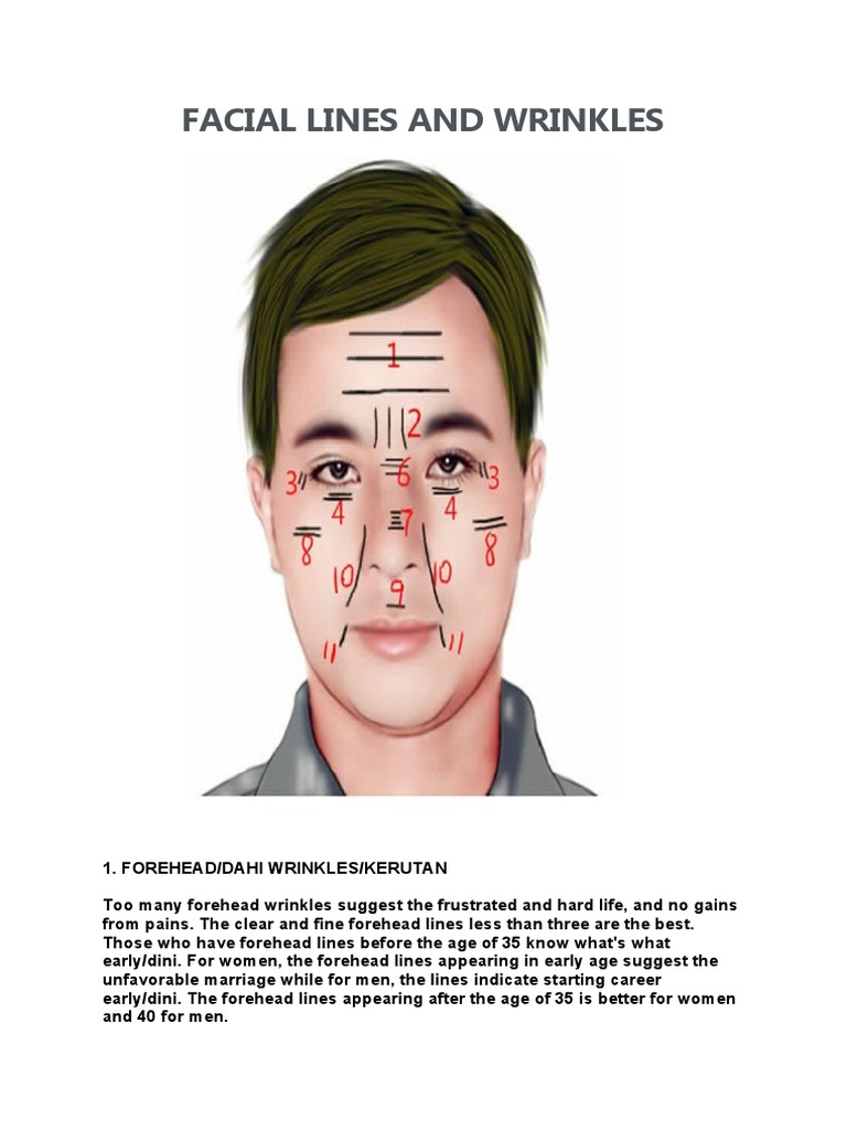 Facial Lines and Wrinkles | PDF | Human Nose | Forehead