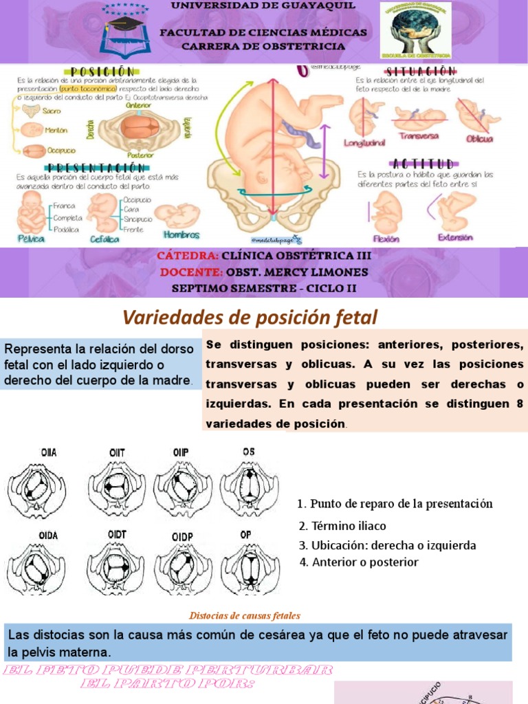 Variedades de Posición Fetal y Distocias | PDF | Parto | Pelvis