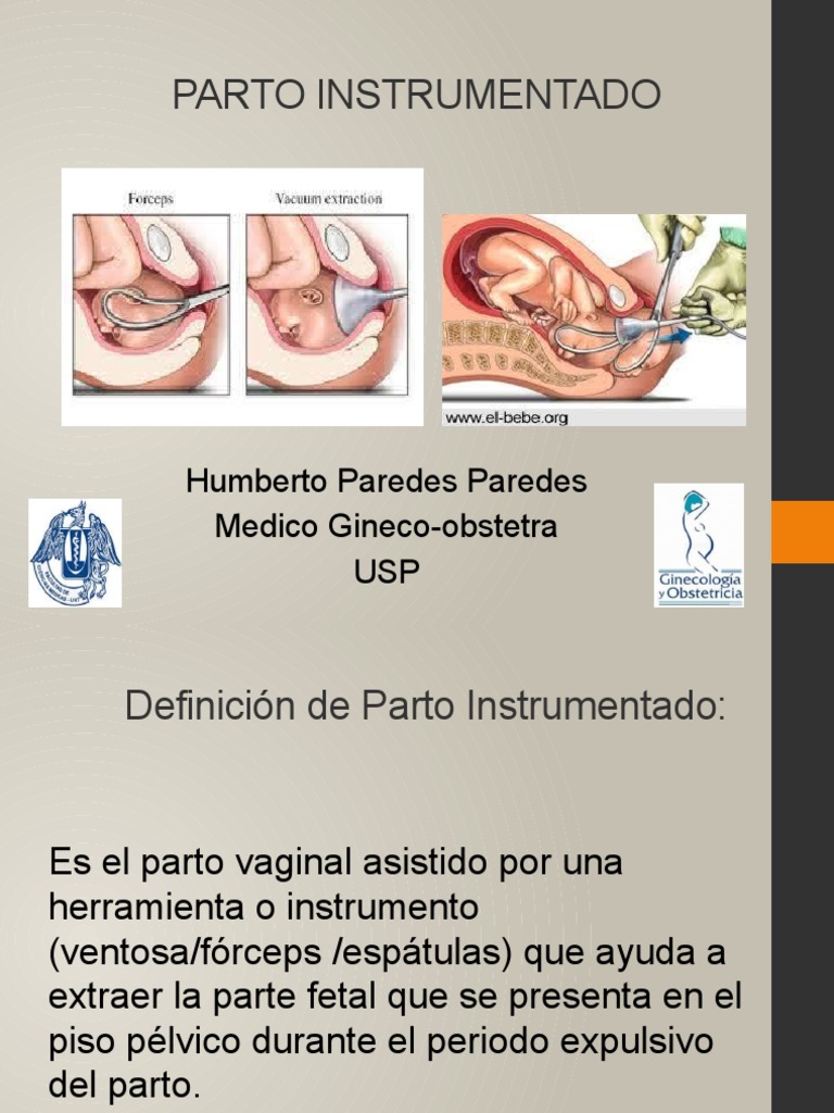 Parto Instrumentado | PDF | Parto | Causas de la muerte