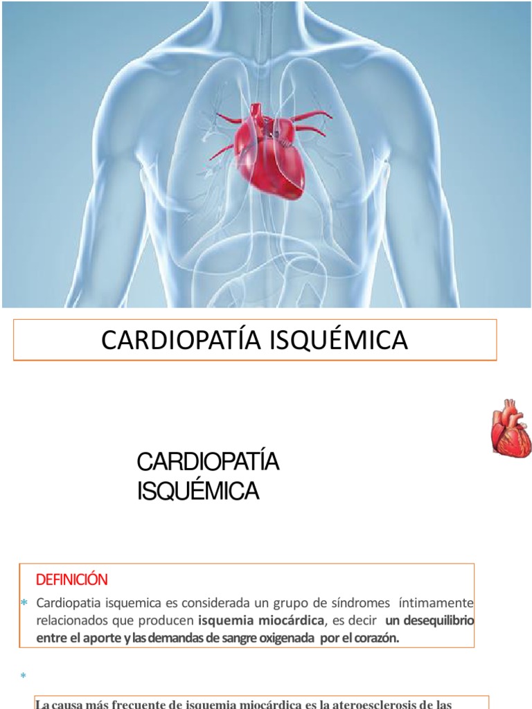 Tratamiento de la Cardiopatía Isquémica | PDF | Isquemia | Infarto de ...