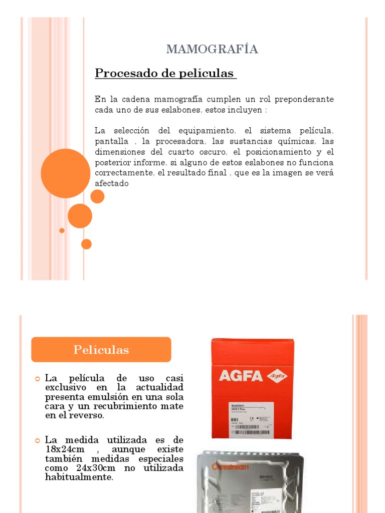 El proceso crucial de procesado de películas mamográficas: Cómo ... El proceso crucial de procesado de películas mamográficas: Cómo ...