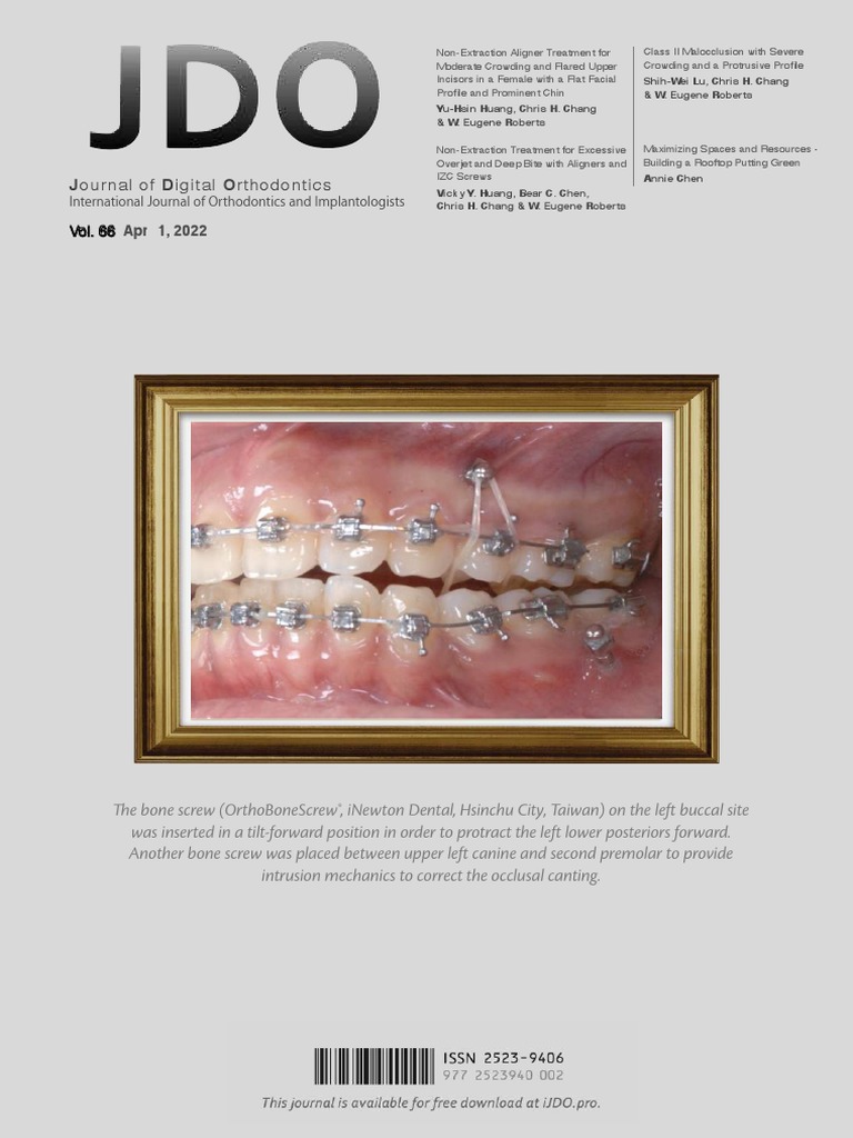 Jdo Vol 66 | PDF | Orthodontics | Dental Anatomy