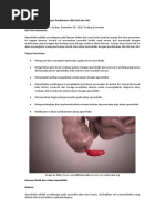 LP Appendicitis | PDF