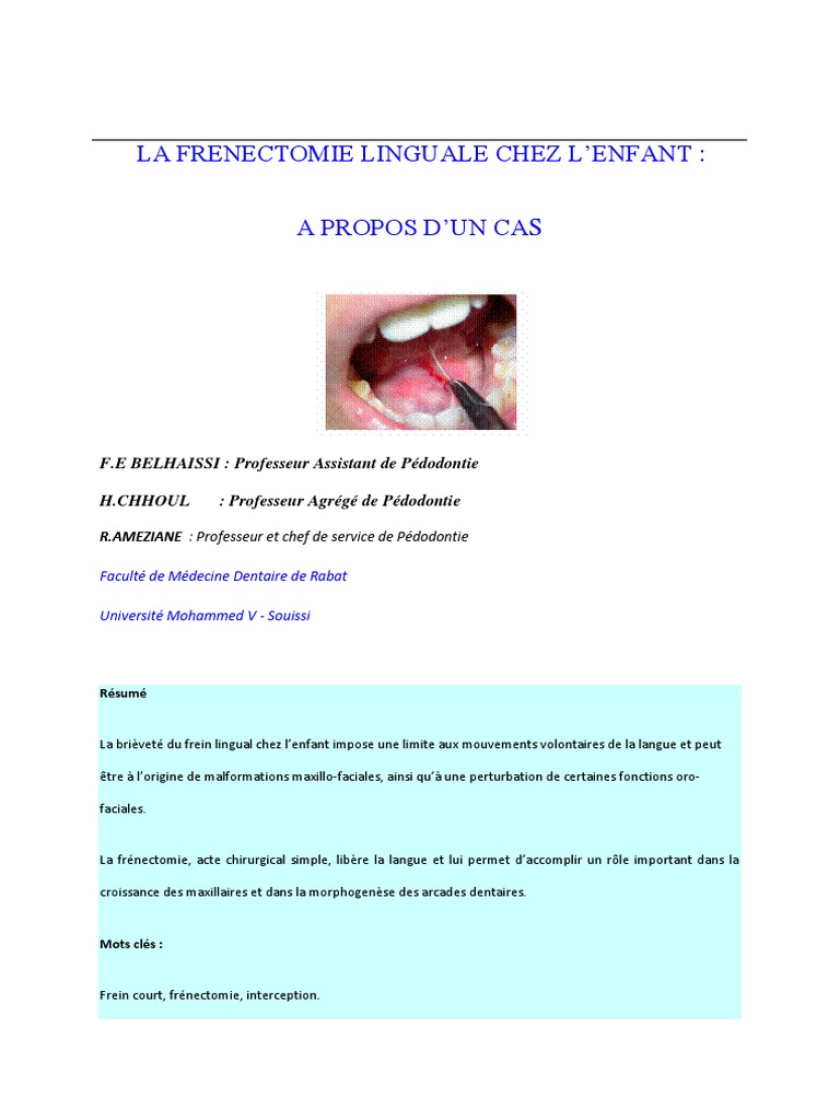 Frénectomie linguale chez l'enfant | PDF | Orthodontie | Bouche