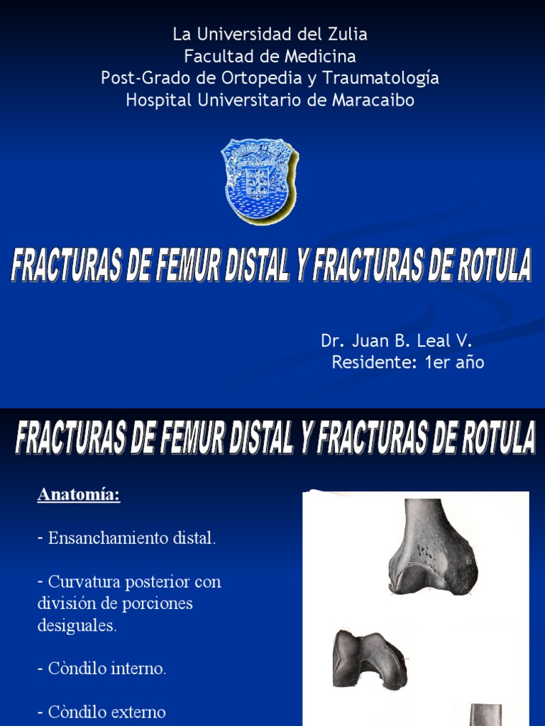 Femur Distal y Rotula | Descargar gratis PDF | Rodilla | Tornillo