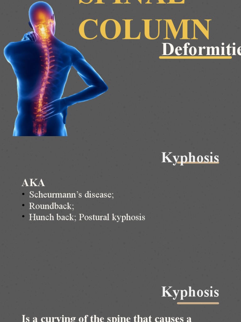 KYPHOSIS | PDF | Health Sciences | Clinical Medicine