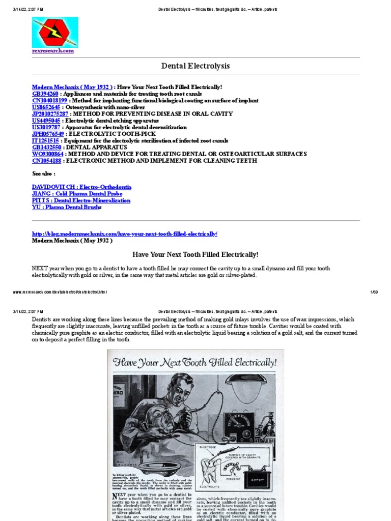 Dental Electrolysis - Fill Cavities, Treat Gingivitis &c. - Article ... Dental Electrolysis - Fill Cavities, Treat Gingivitis &c. - Article ...