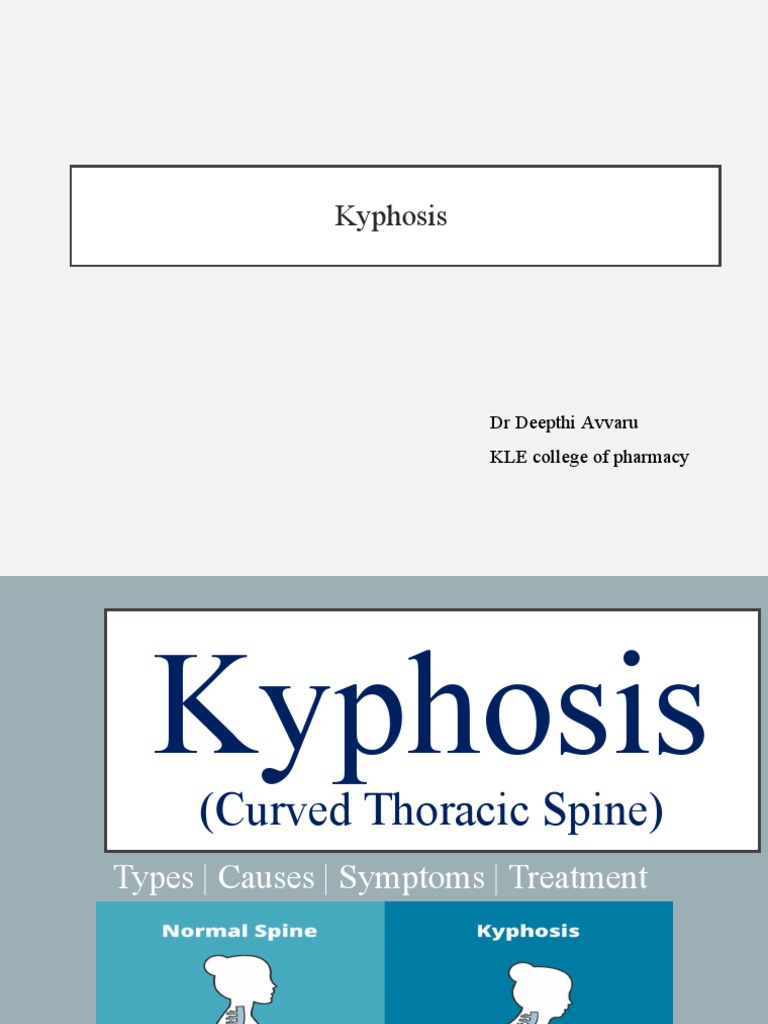Kyphosis Assignment | PDF | Musculoskeletal Disorders | Epidemiology