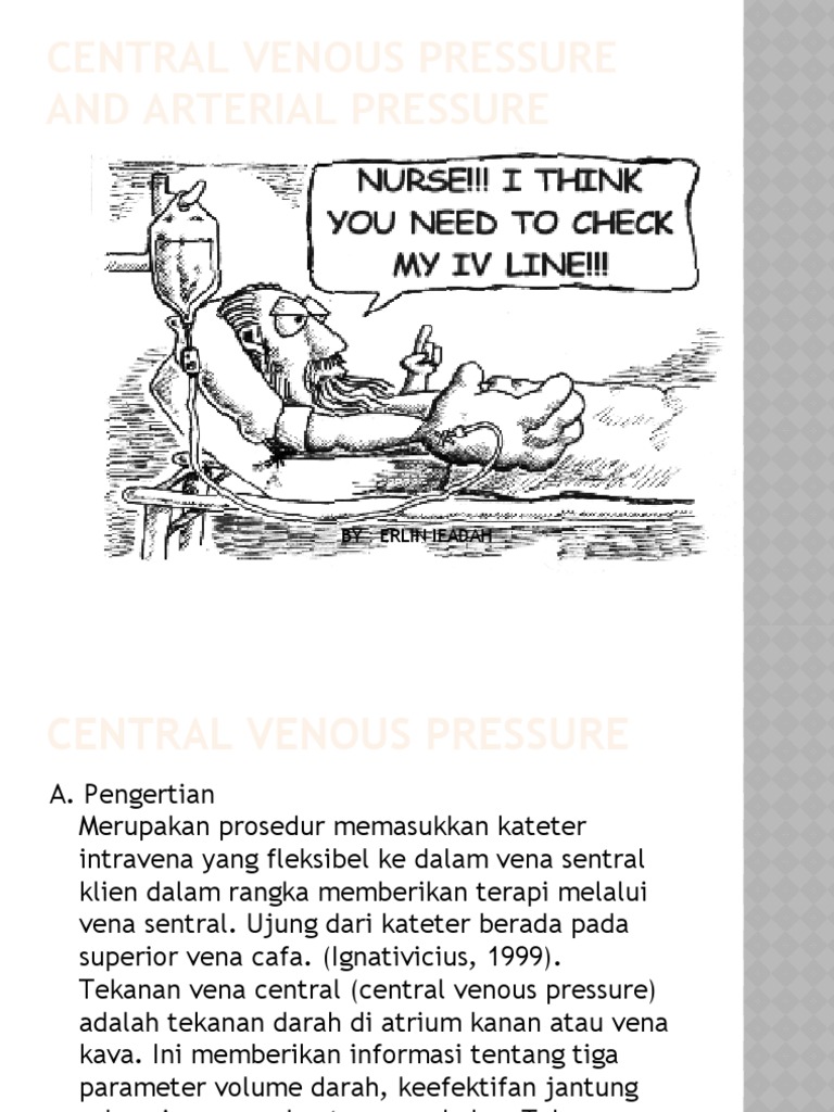 CVP Dan Arteri Line | PDF