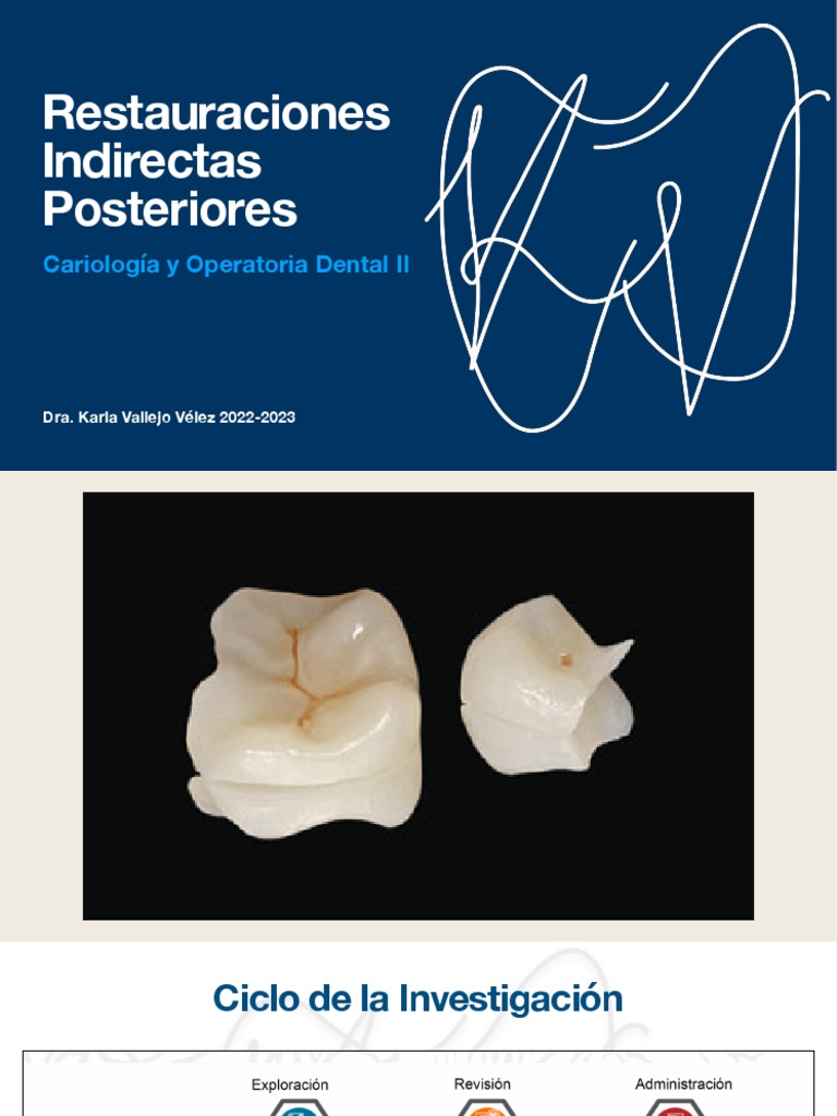 Restauraciones Indirectas Posteriores | PDF | Compuesto Dental ...