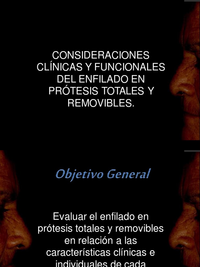 Consideraciones Clínicas y Funcionales Del Enfilado en Prótesis Totales ...