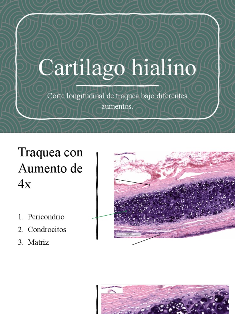 Cartilago Hialino | PDF