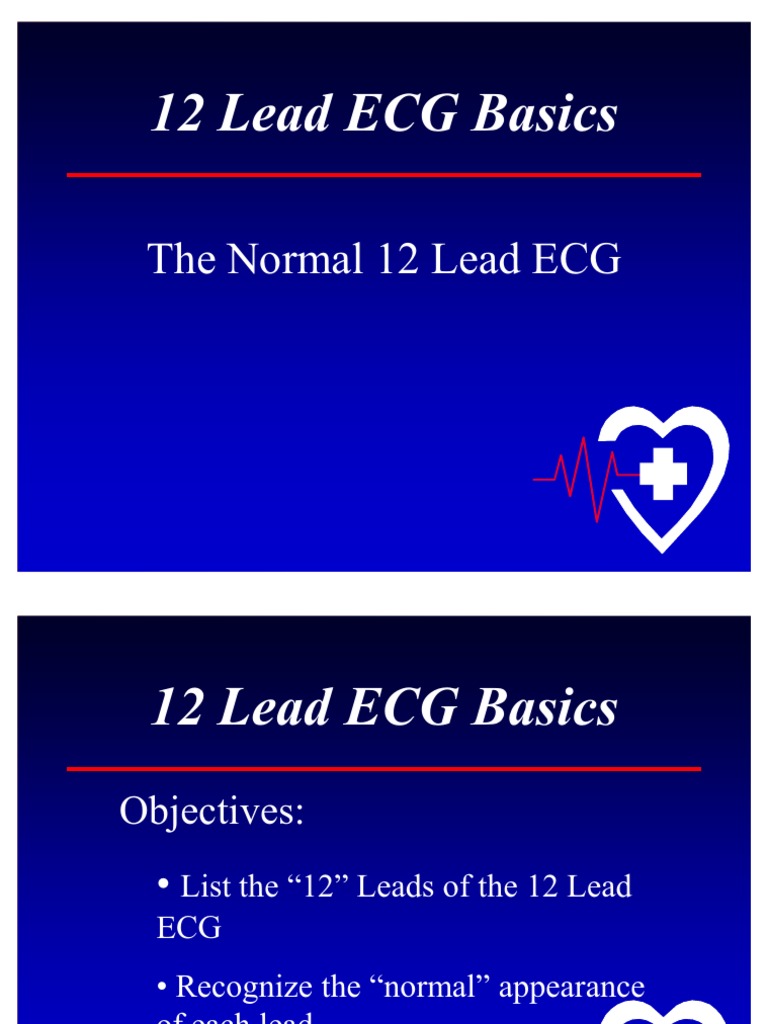 Leads 12 Lead ECG Basics | PDF