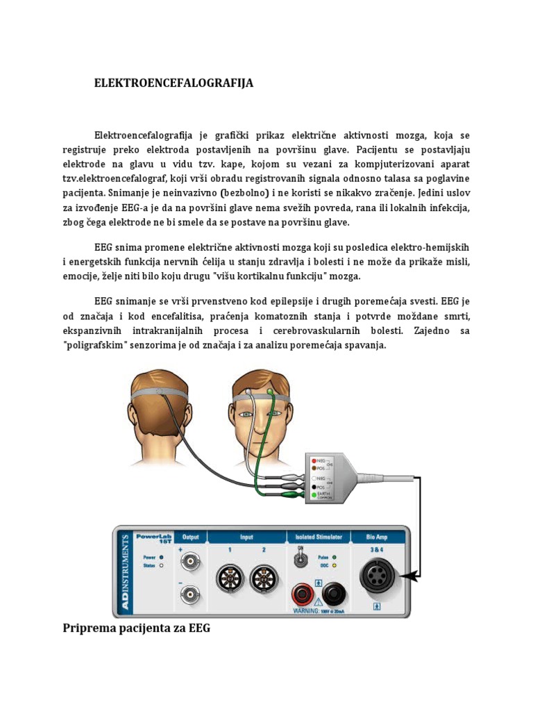 Elektroencefalografija | PDF