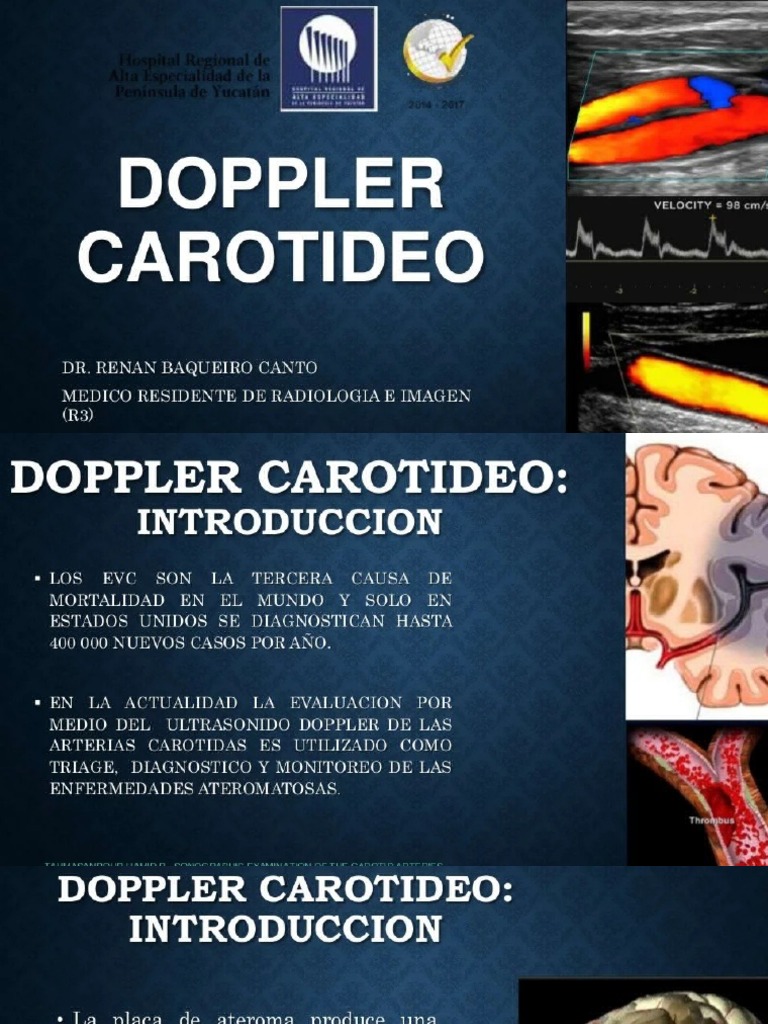 Doppler Carotídeo y Vértebral | PDF