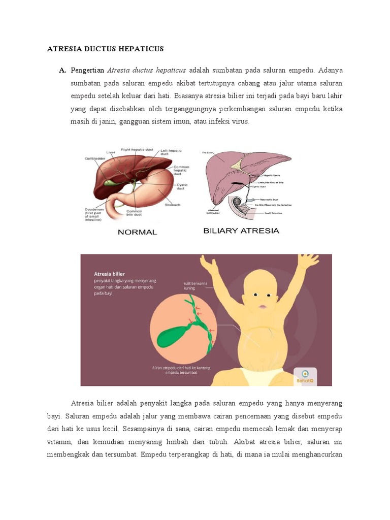 Materi Atresia Duktus Hepatikus | PDF | Kesehatan Holistik