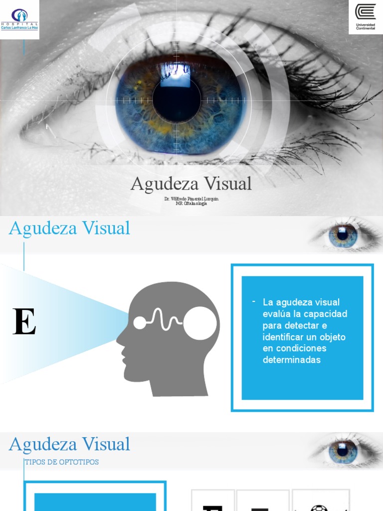 Agudeza Visual | PDF