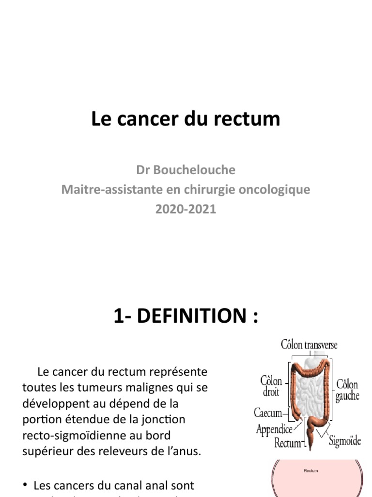 Cancer du Rectum : Définition, Épidémiologie et Diagnostic | PDF ...