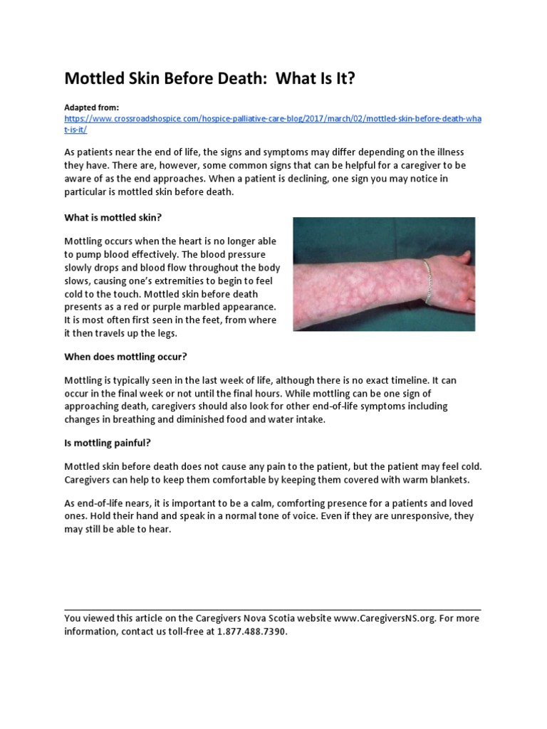 Mottled Skin | PDF | Lifestyle