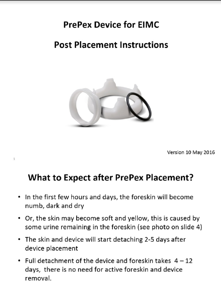 Prepex | PDF
