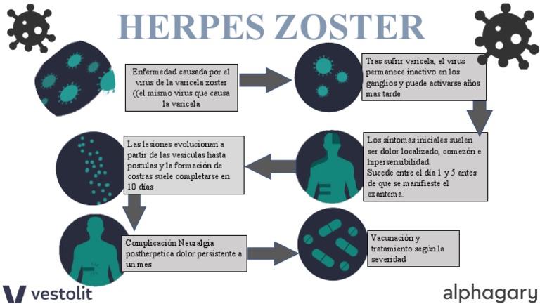Herpes Zoster | PDF