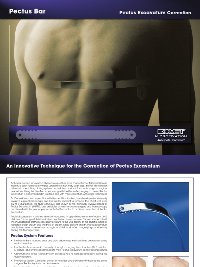 Pectus Bar Overview Technique | PDF | Surgery | Clinical Medicine