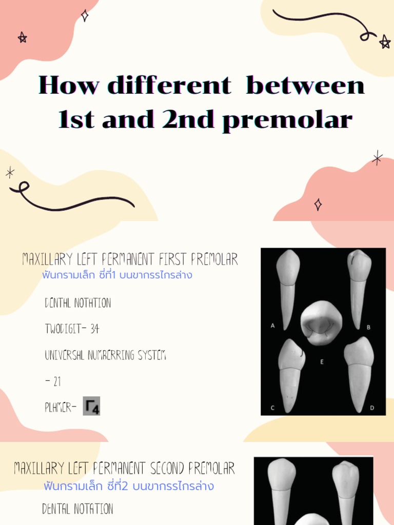 กลุ่ม6 Mandibular permanent 1st กับ 2nd premolarเลขที่3 - 18 - 19 | PDF