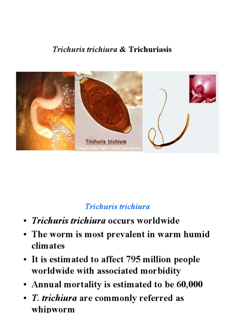 2. Trichuris trichiura | PDF | Diseases And Disorders | Digestive System