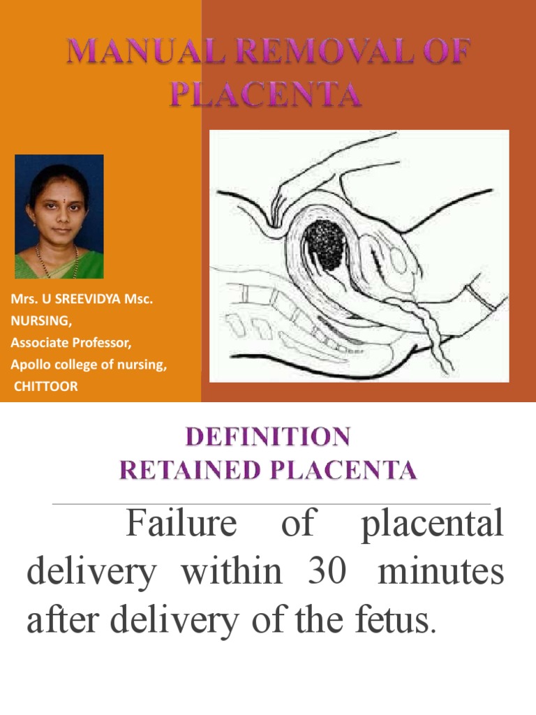 Manual Removal of Retained Placenta Procedures | PDF | Uterus | Placenta