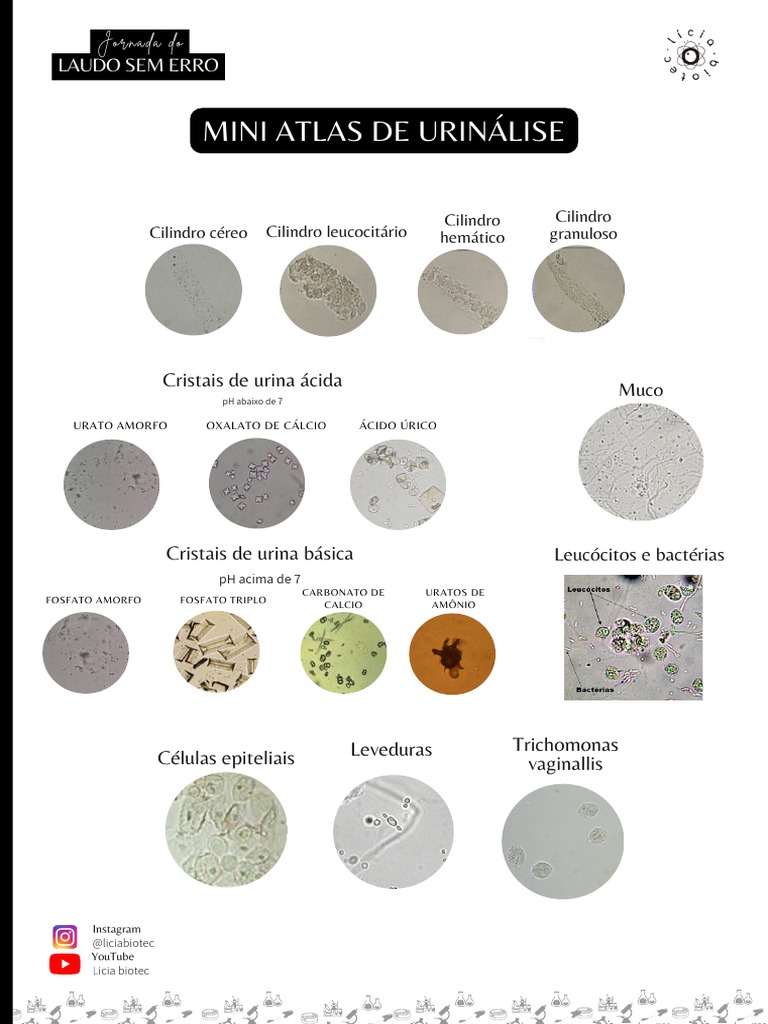 Mini Atlas de Urinálise | PDF