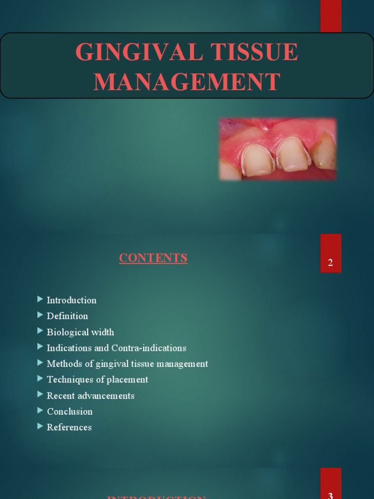 Gingival Tissue Management Techniques | PDF