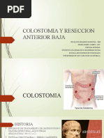 Cirugía de Hartmann: Técnica y Procedimiento | PDF | Cáncer colonrectal ...