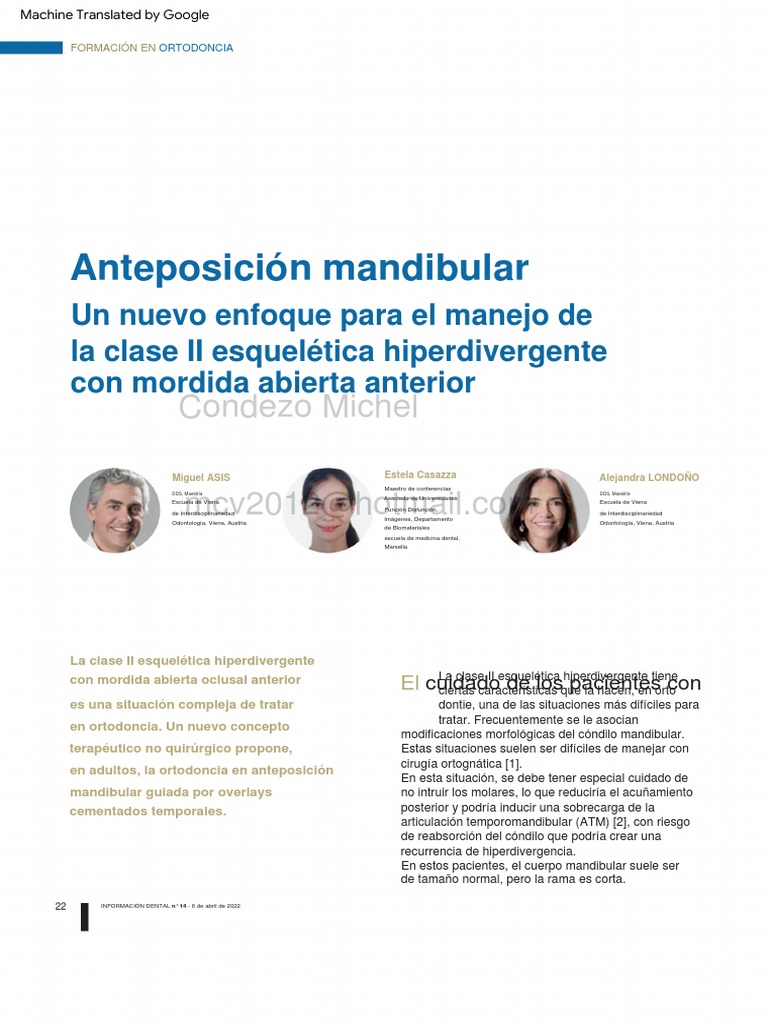 Manejo de Clase II Hiperdivergente | PDF | Ortodoncia | Odontología
