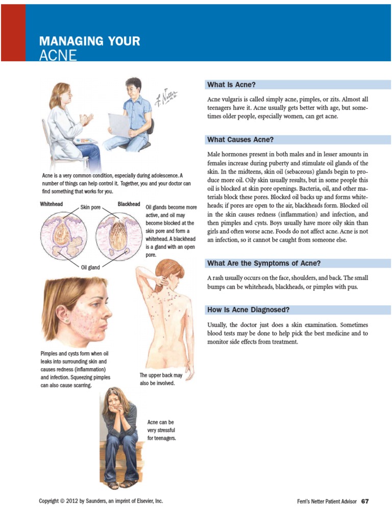 Acne Netter | PDF | Pimple | Dermatology