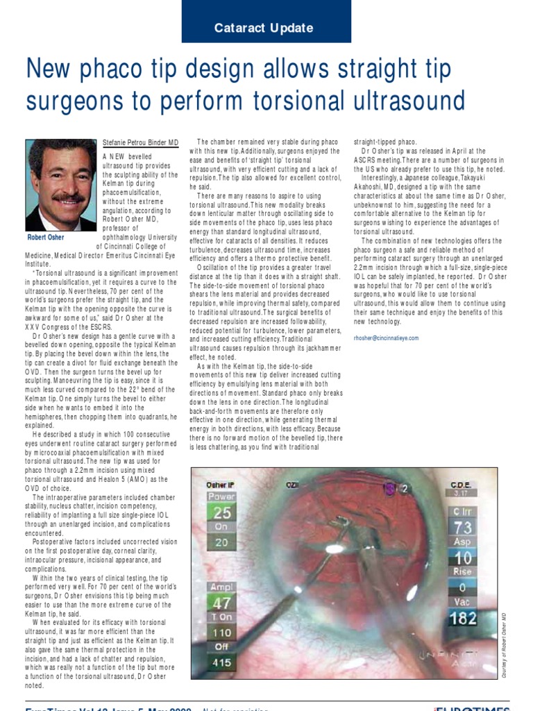 New Phaco Tip Design Allows Straight Tip Surgeons To Perform Torsional ...
