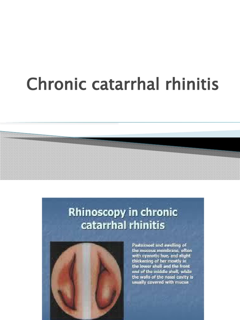 Chronic Catarrhal Rhinitis | PDF | Human Nose | Mucus