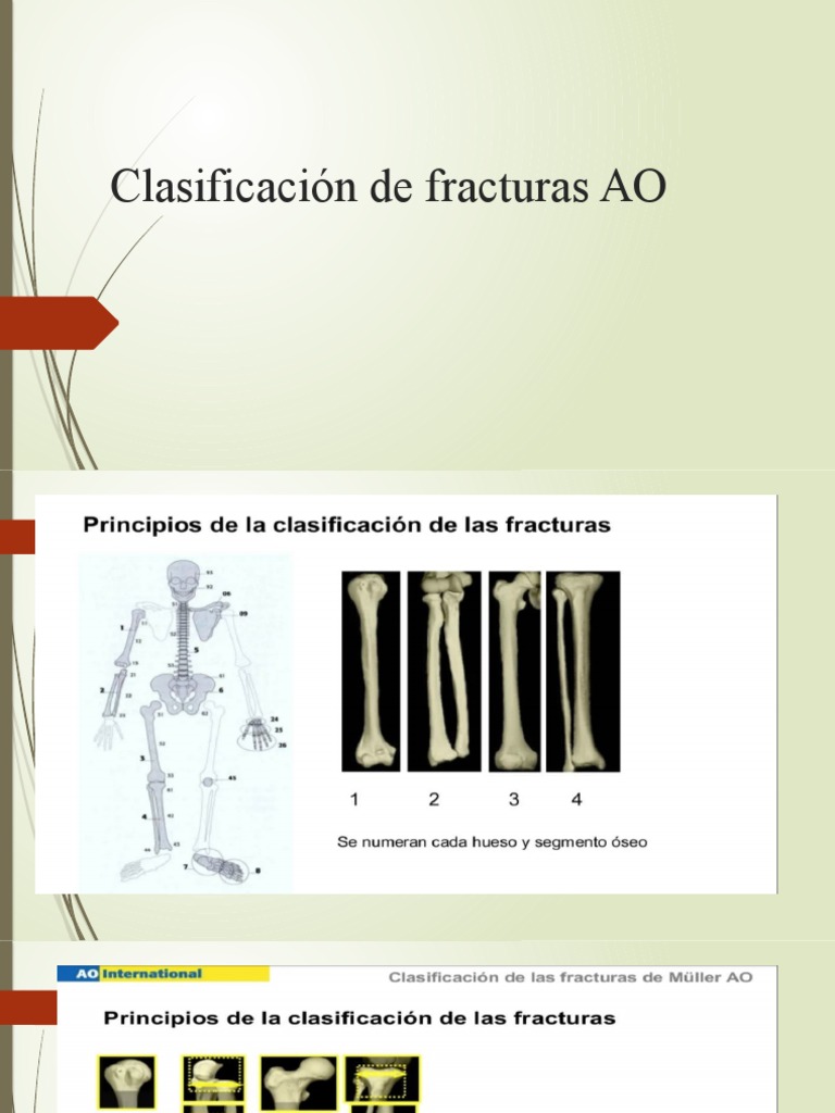 Clasificación de Fracturas AO | PDF