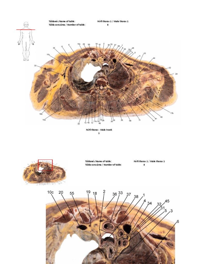 Cross-Sectional Anatomy - Male Thorax | PDF | Thorax | Vertebra