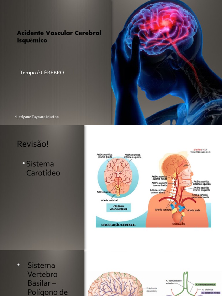 Revisão sobre os principais aspectos do acidente vascular cerebral ...