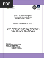 Pitch y TC Helicoidal | PDF | Ct Scan