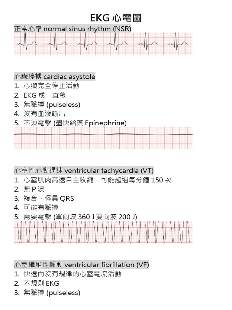 EKG心電圖 | PDF