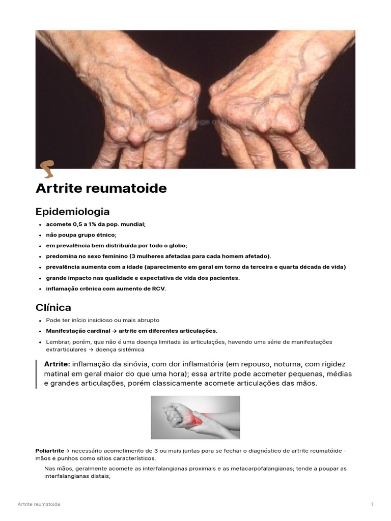 Artrite Reumatoide: Epidemiologia, Manifestações Clínicas, Diagnóstico ...